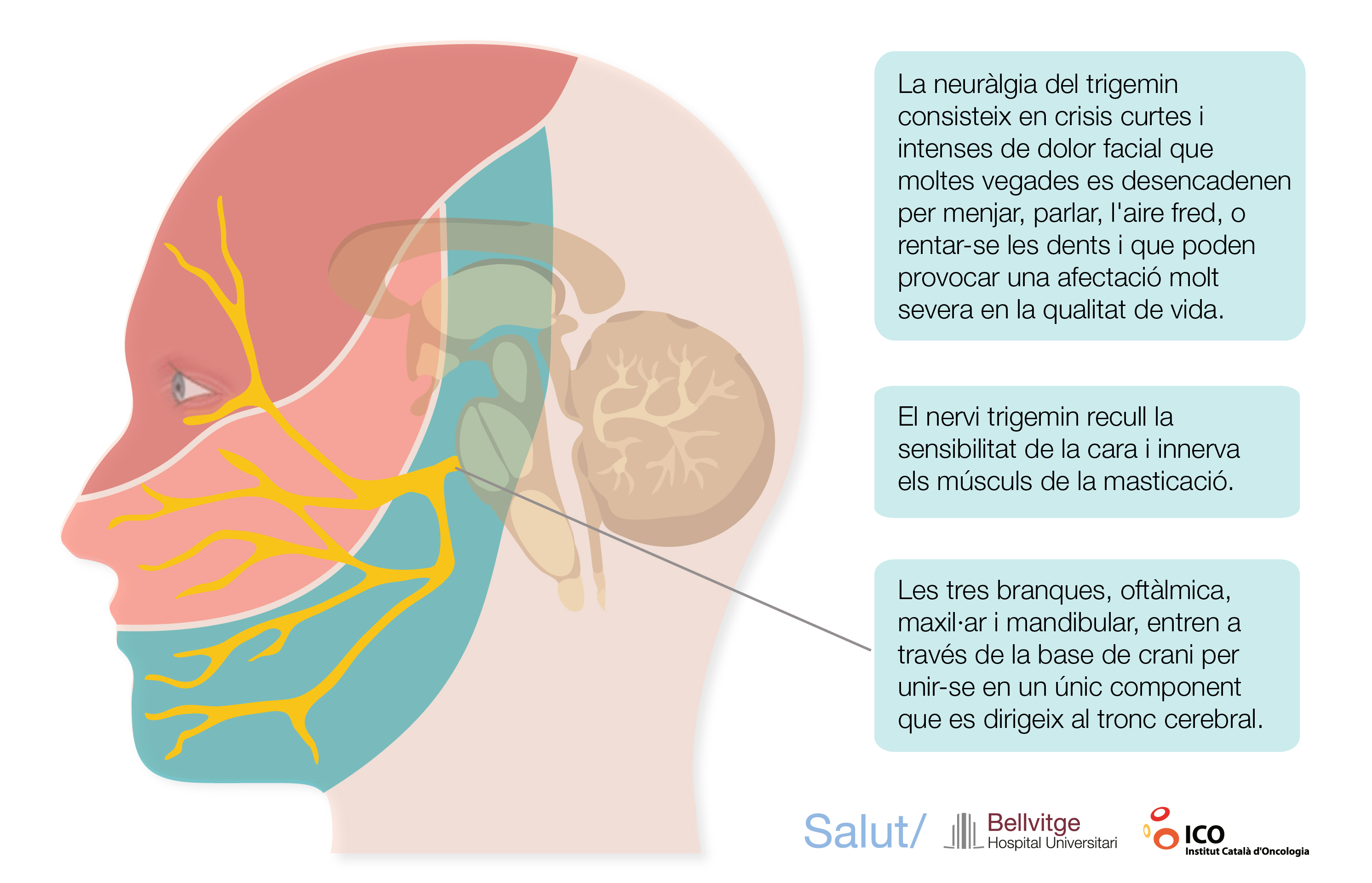 neuralgia-del-trig-mino-qu-es-hospital-de-bellvitge