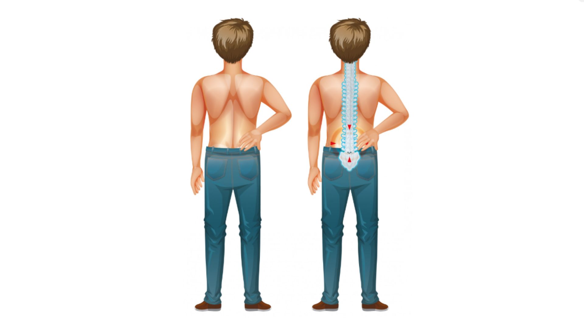 Cirugía de estenosis de canal lumbar: detalles clave | Hospital de ...