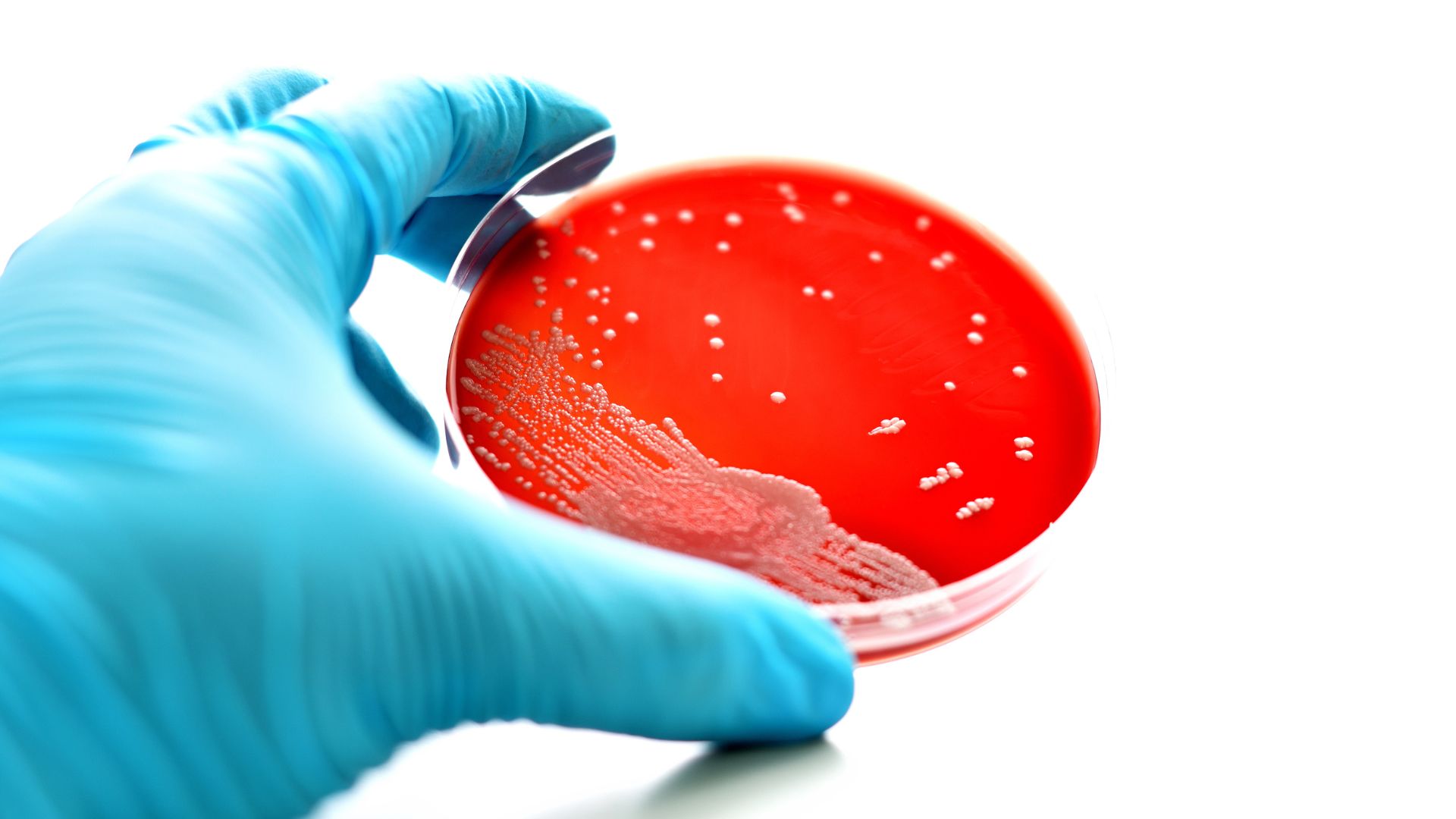 Desmontamitos: 10 falsos mitos sobre la osteomielitis | Hospital de ...