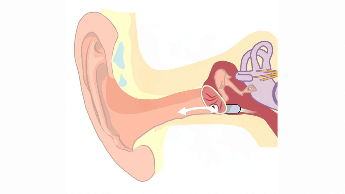 Endoscopia nasosinusal: todos los detalles | Hospital de Bellvitge